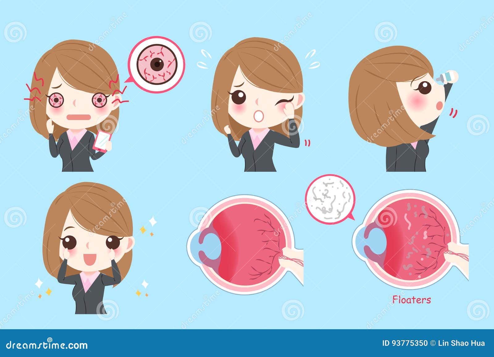 Muscae Volitantes Eyes Clipart