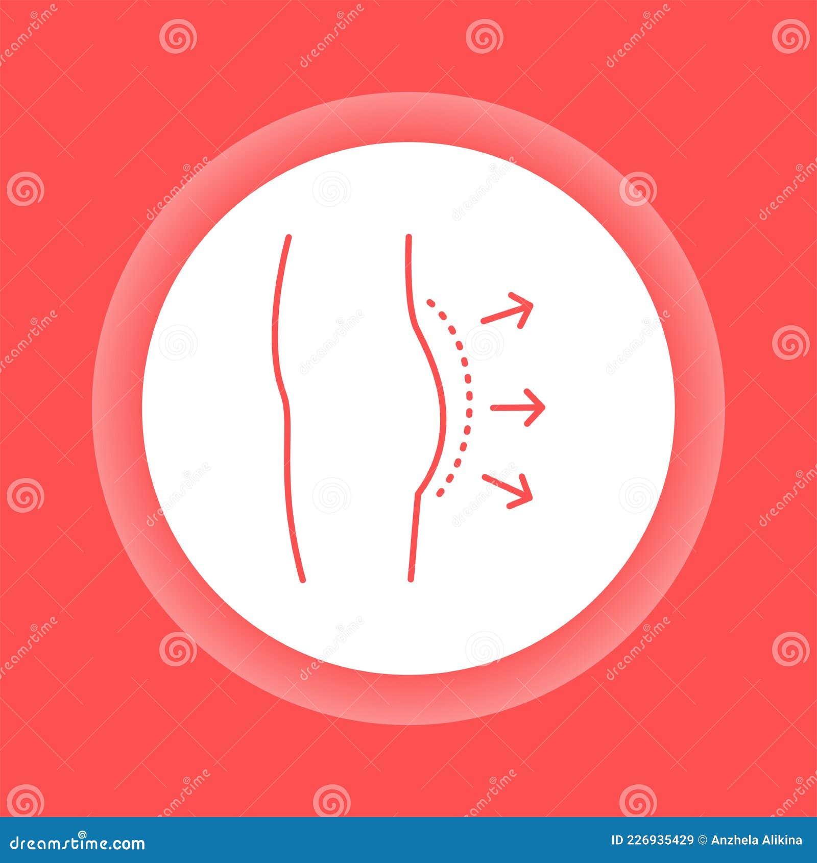 Buttock Augmentation Color Button Icon. Plastic Body Surgery Stock ...