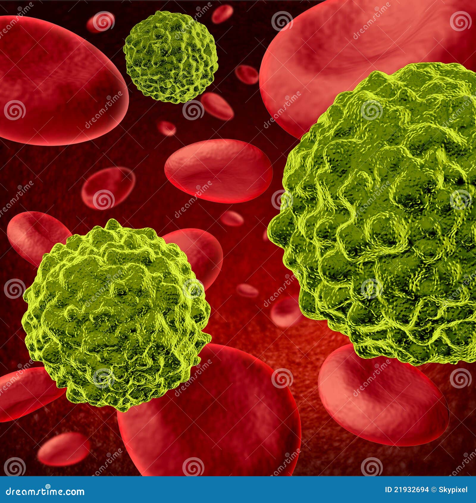 Cáncer humano stock de ilustración. Ilustración de enfermedad - 21932694