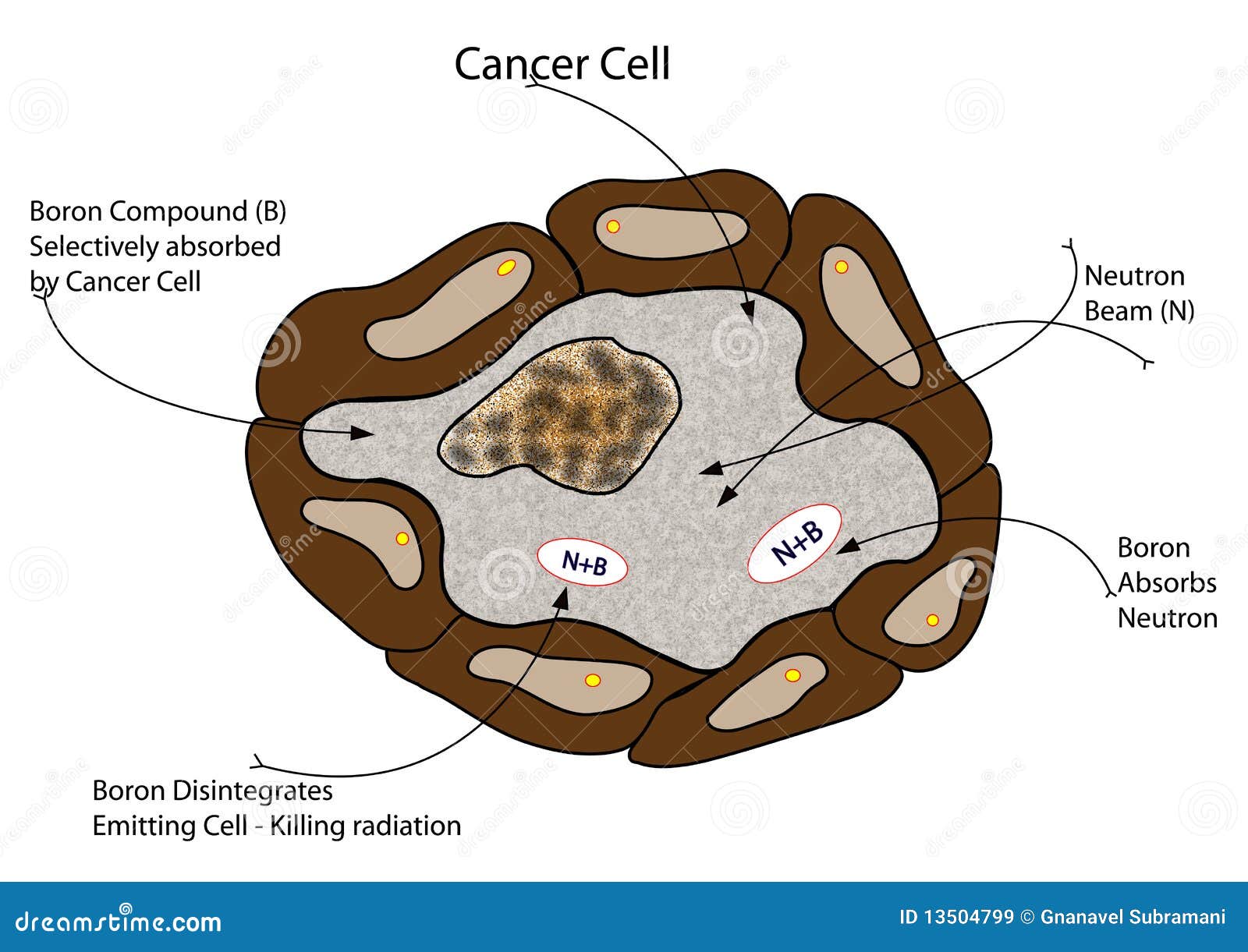 Célula cancerosa ilustração stock. Ilustração de tumor - 13504799