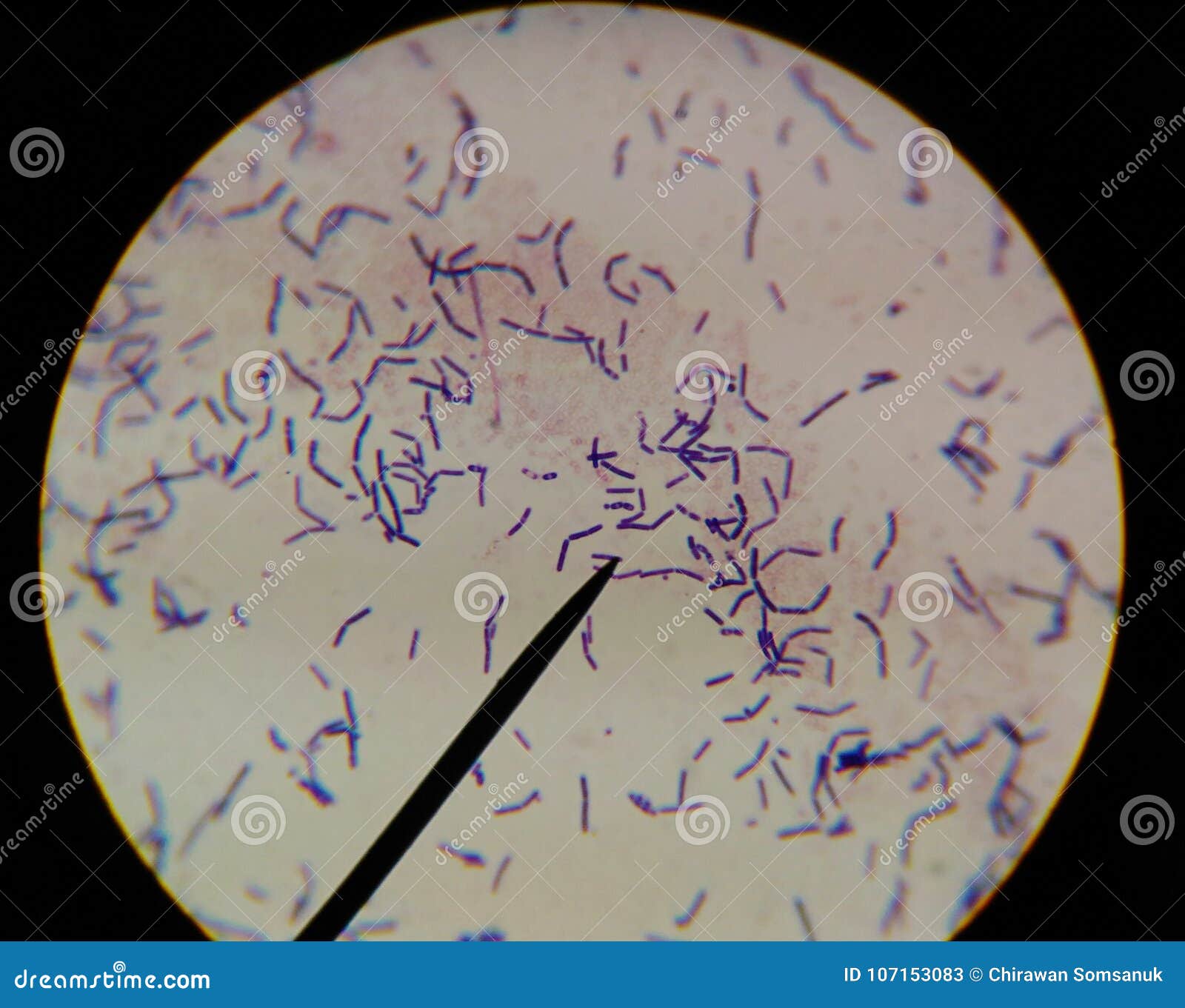 Microscopiodebacterias