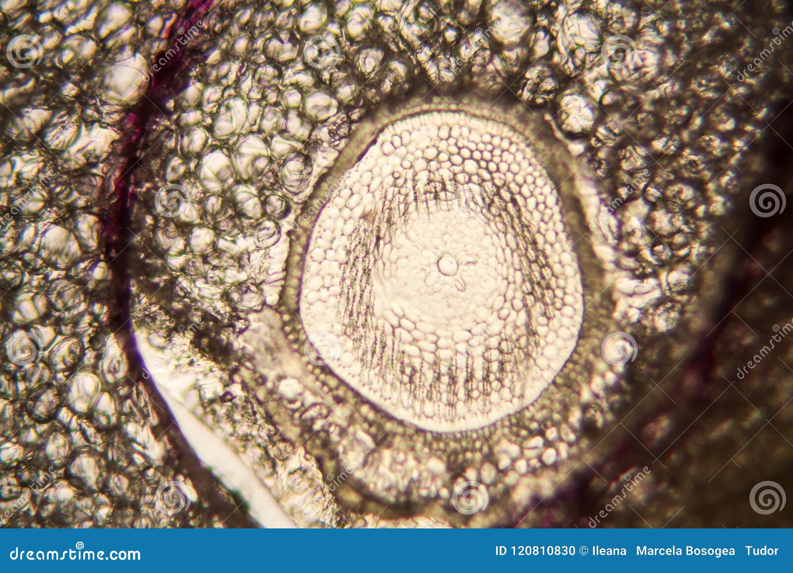 Células De Raíz De La Cebolla En El Microscopio Foto de archivo ...