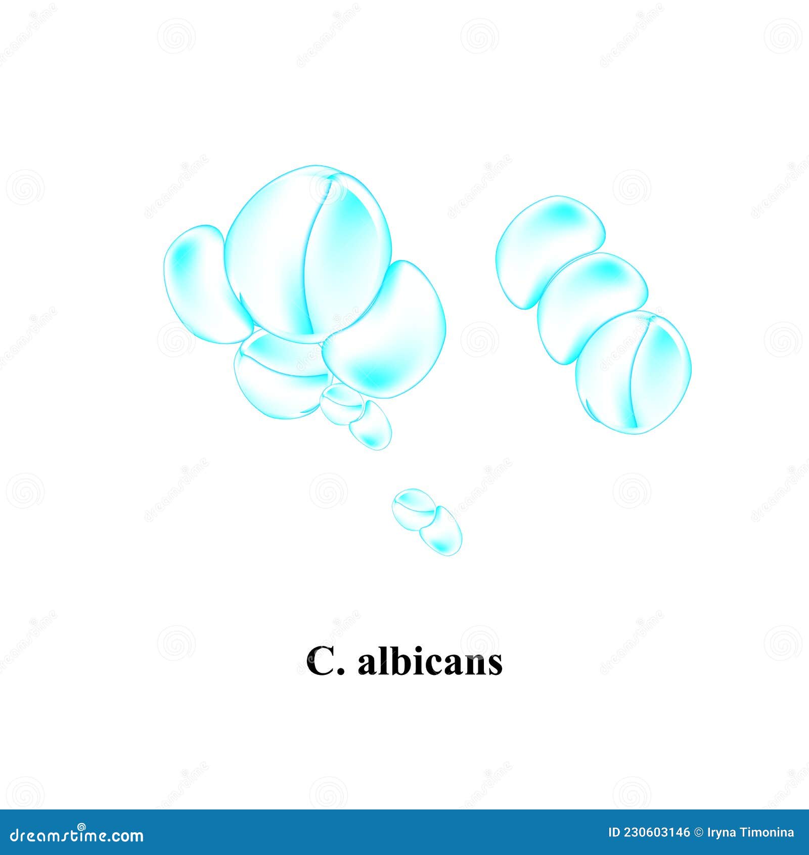 Vaginal Mucosa Of The Patient Of The Candidiasis Cartoon Vector ...