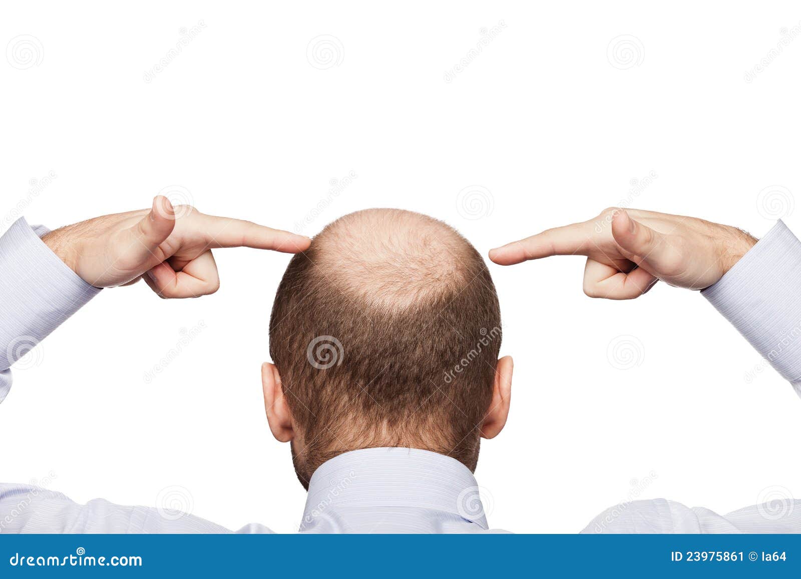 Cabeça calva do homem imagem de stock. Imagem de macho - 23975861