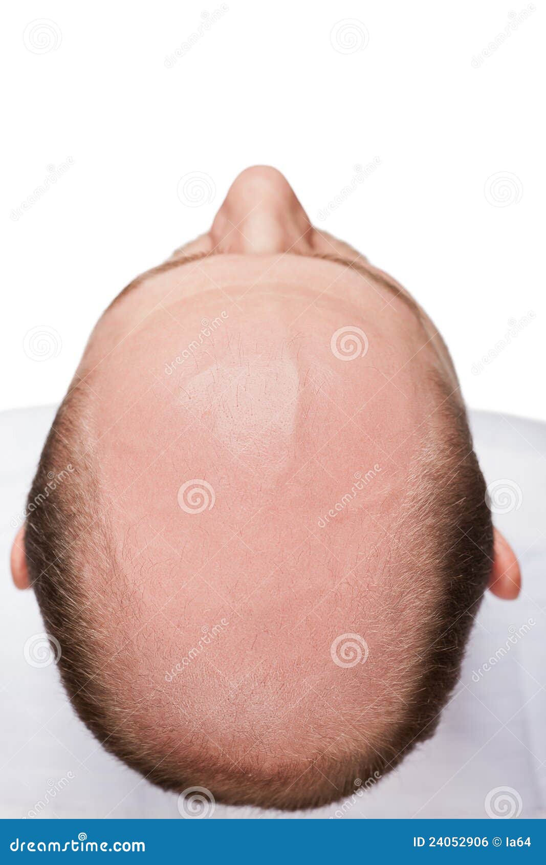 Cabeça calva do homem foto de stock. Imagem de traseira - 24052906