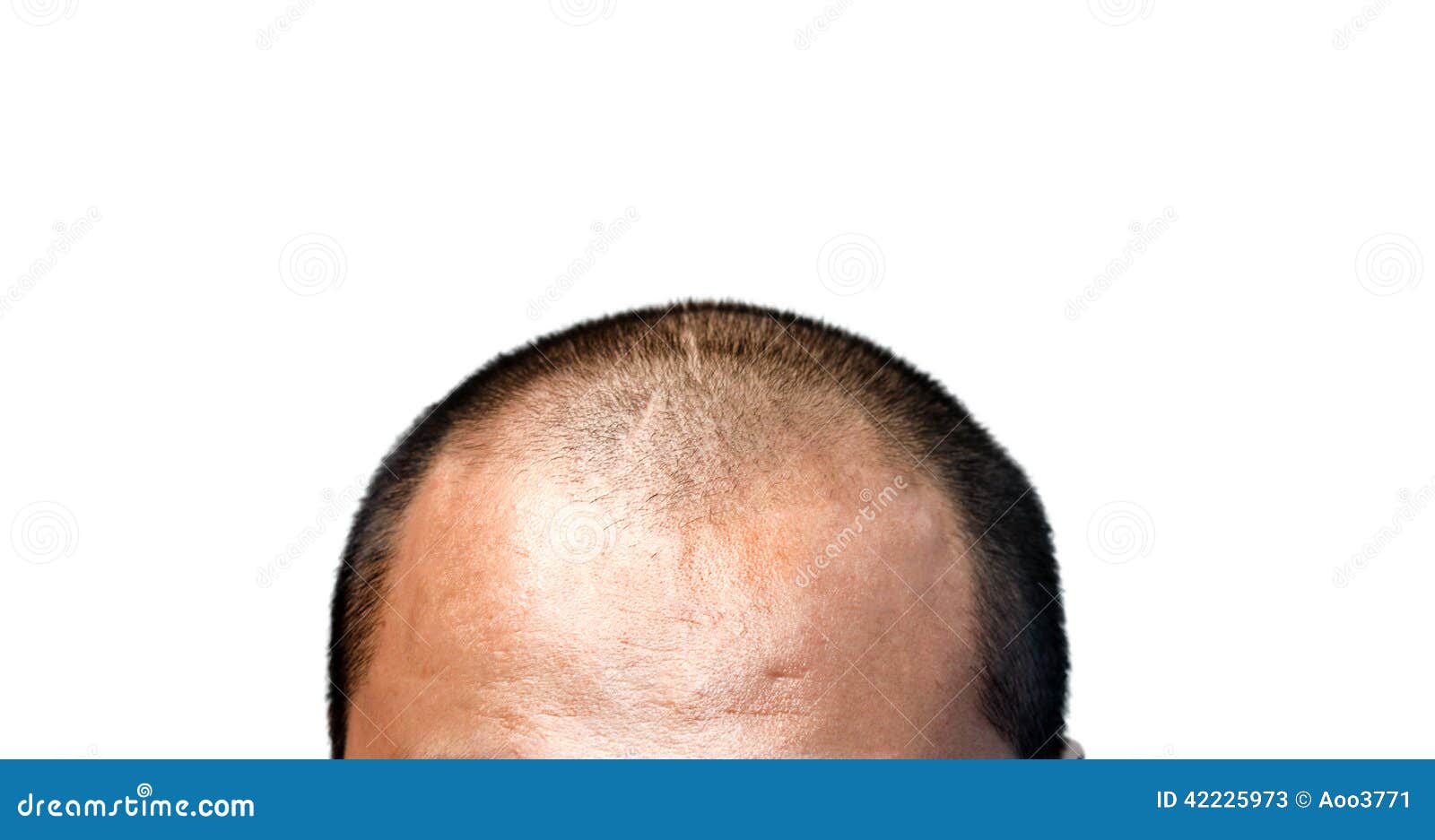 Cabeza calva imagen de archivo. Imagen de mirando, pista - 42225973
