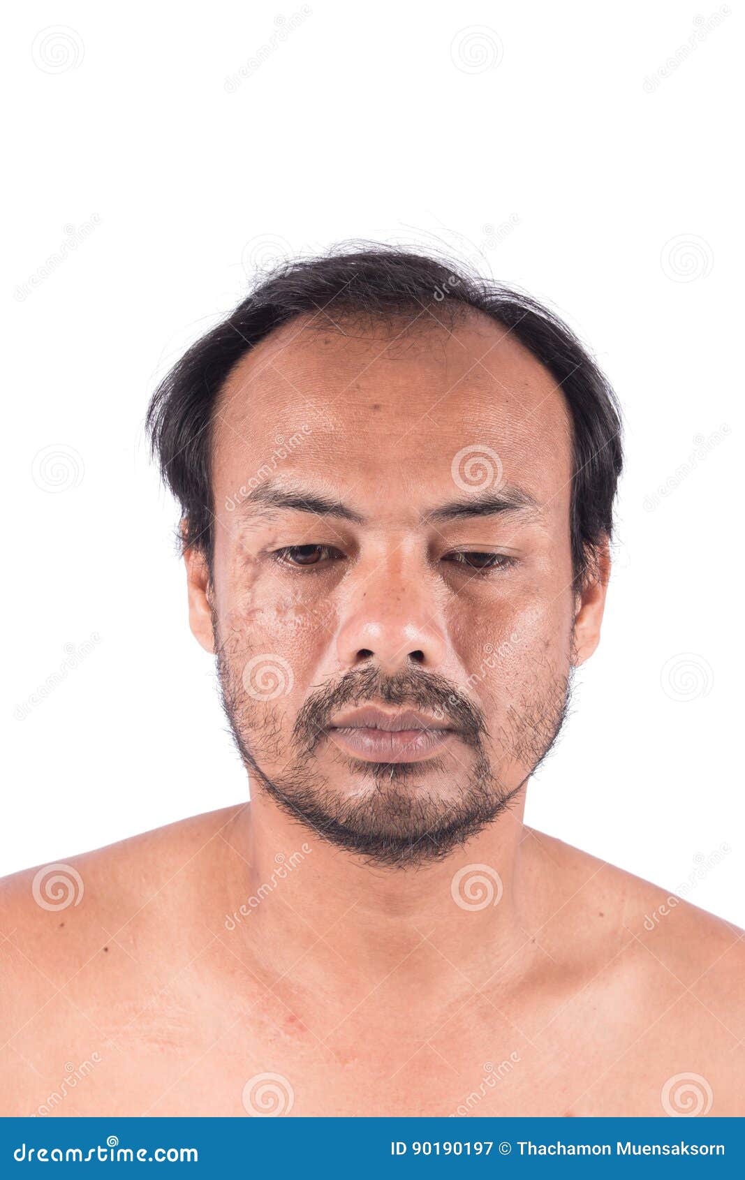 Cabeza Calva Del Hombre De La Cara Imagen de archivo - Imagen de perfil ...