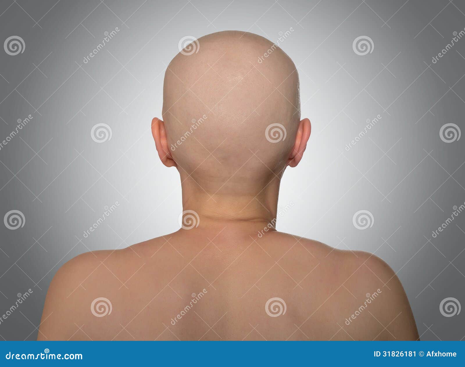 Cabeza Calva, Vista Posterior Imagen de archivo - Imagen de persona ...