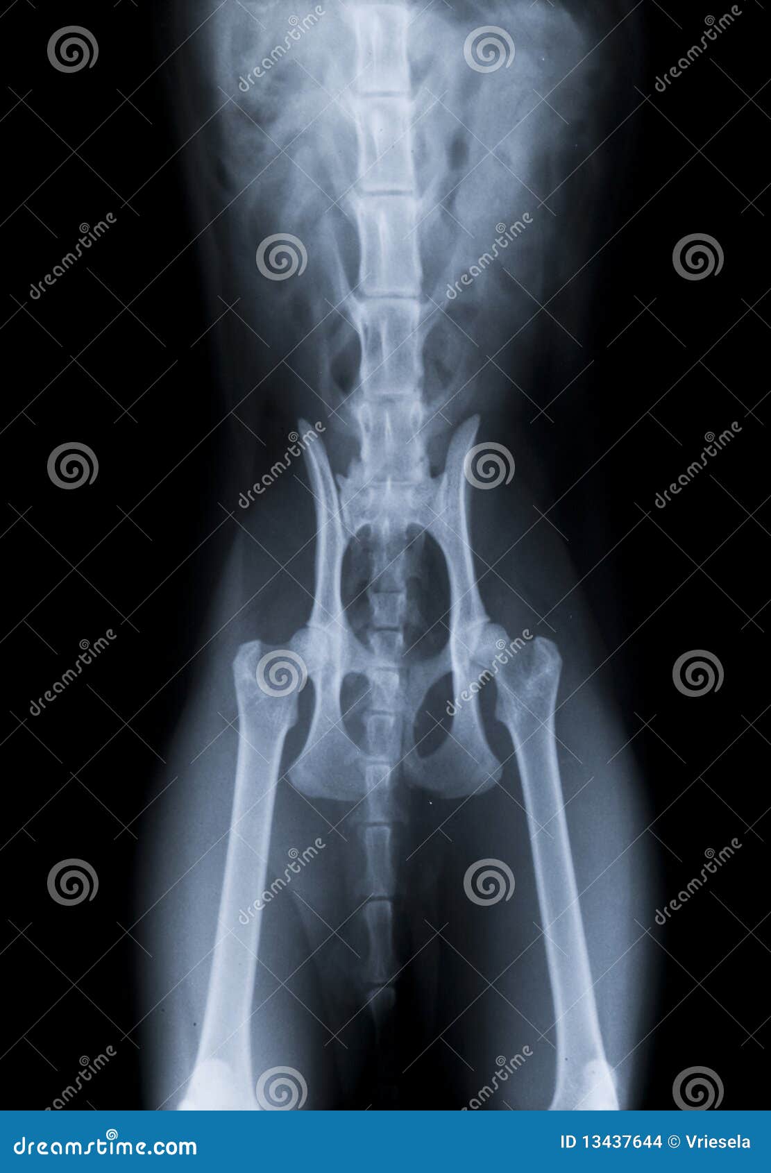 Cadera de la radiografía foto de archivo. Imagen de imagen - 13437644