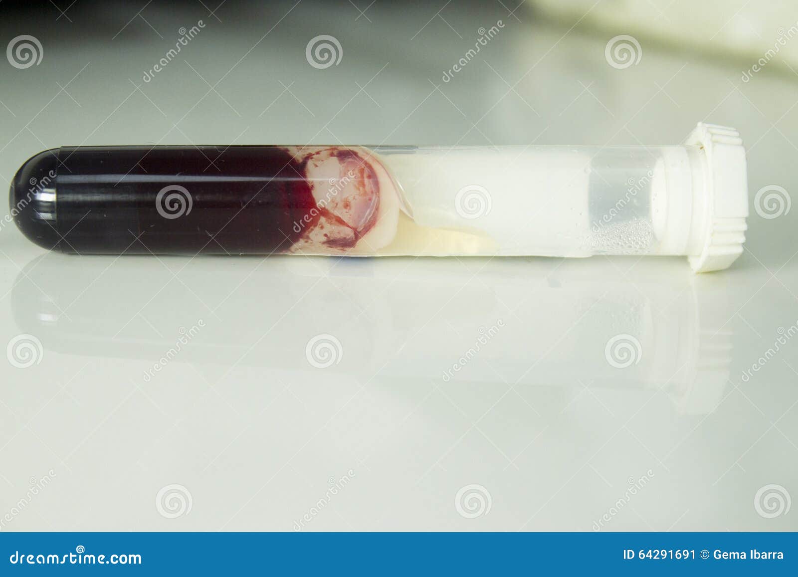 Caillot sanguin image stock. Image du studio, biochimie - 64291691