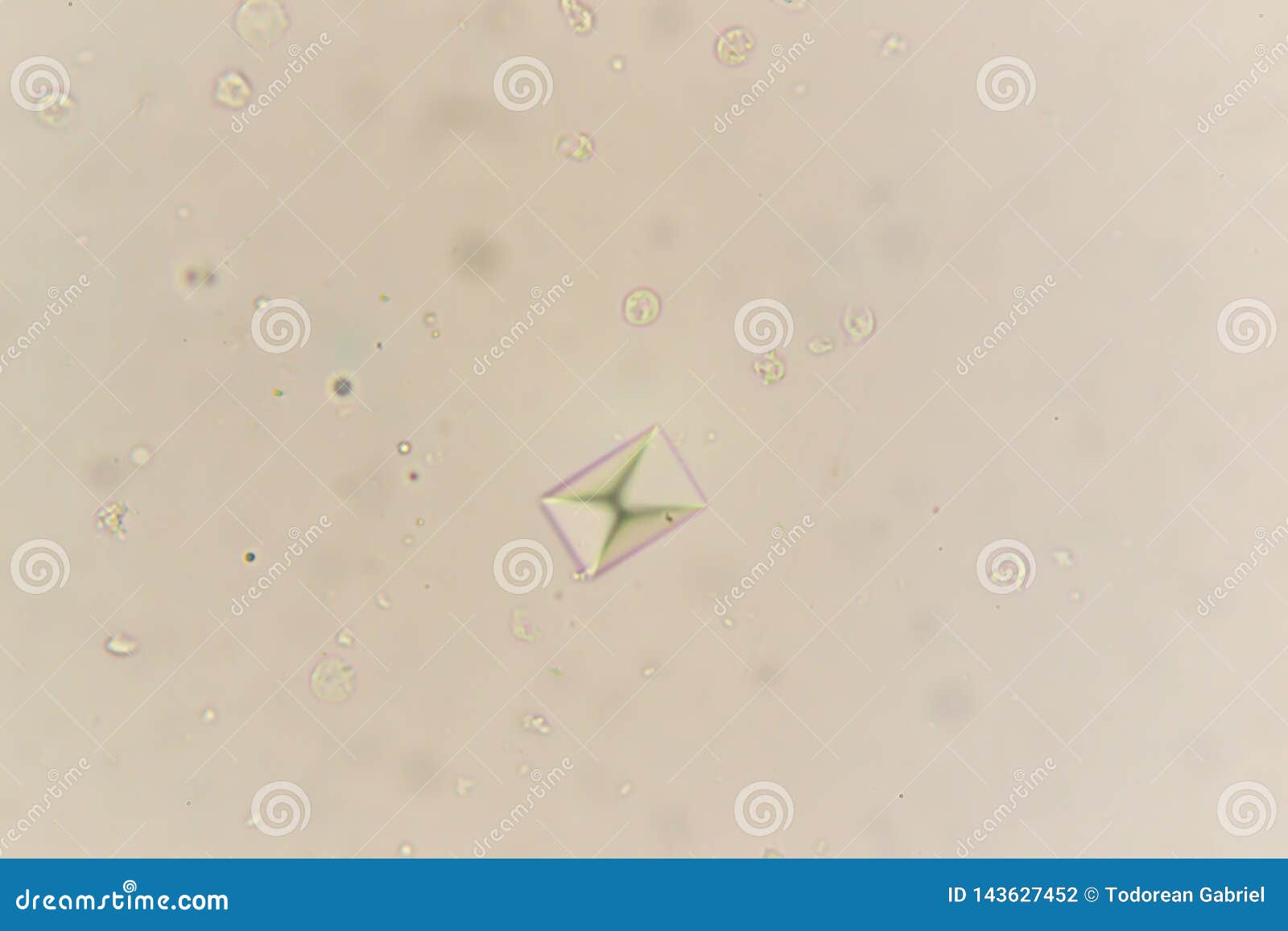 Struvites At The Microscope Royalty-Free Stock Image | CartoonDealer ... Struvites At The Microscope Royalty-Free Stock Image | CartoonDealer ...