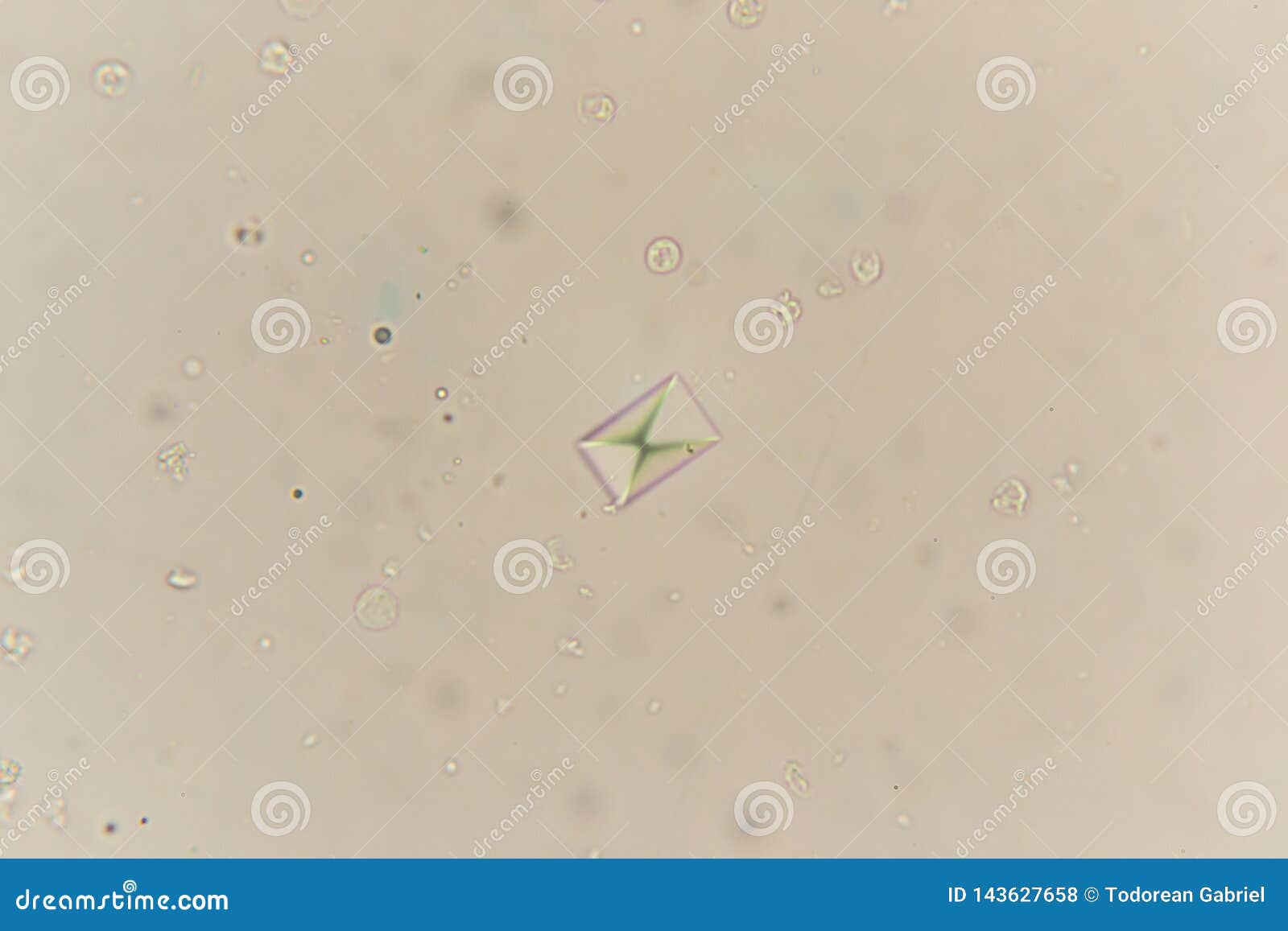 Struvites At The Microscope Royalty-Free Stock Image | CartoonDealer ... Struvites At The Microscope Royalty-Free Stock Image | CartoonDealer ...