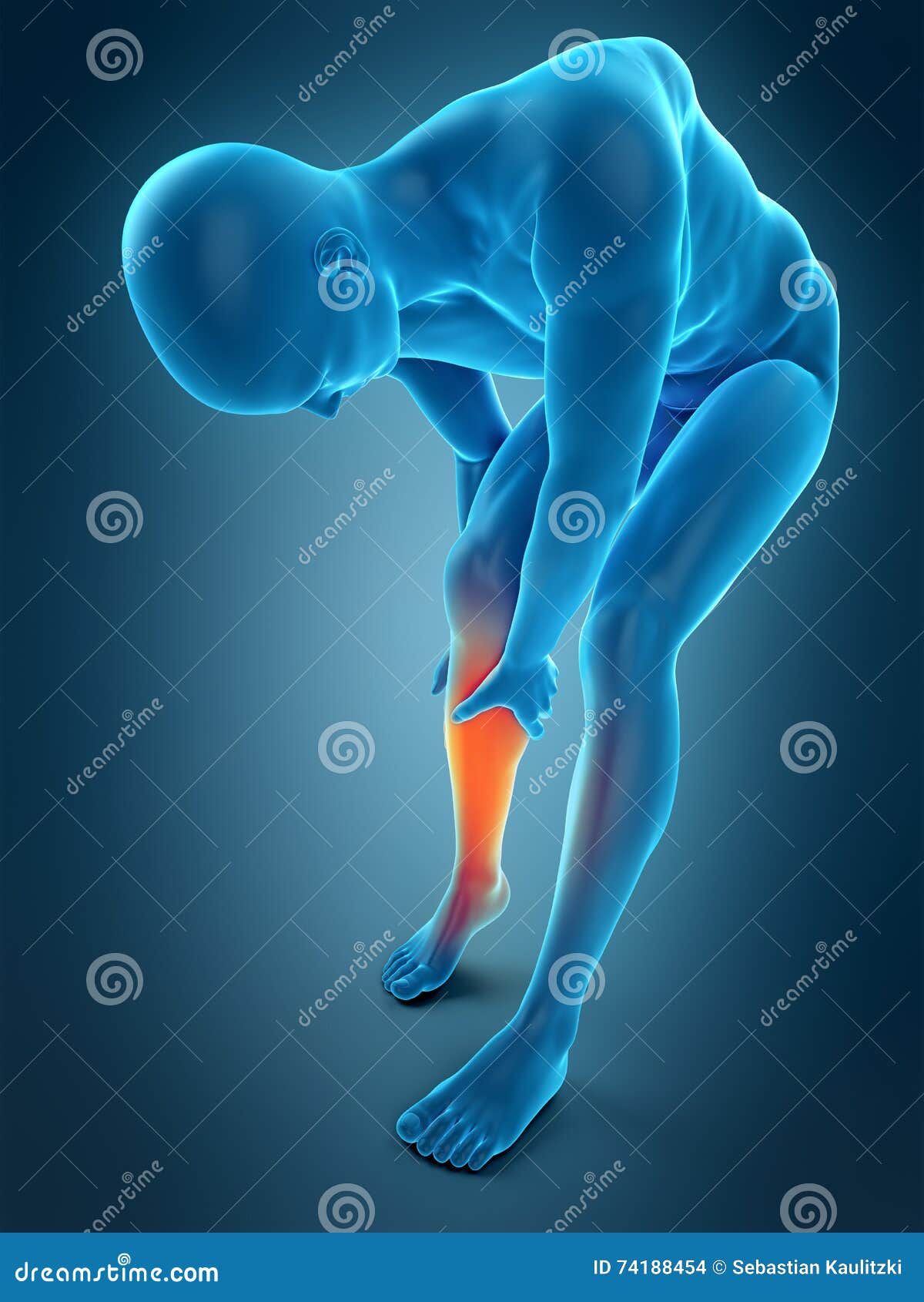 Calf Pain Explanation With Cramp From Muscle Contraction Outline ...