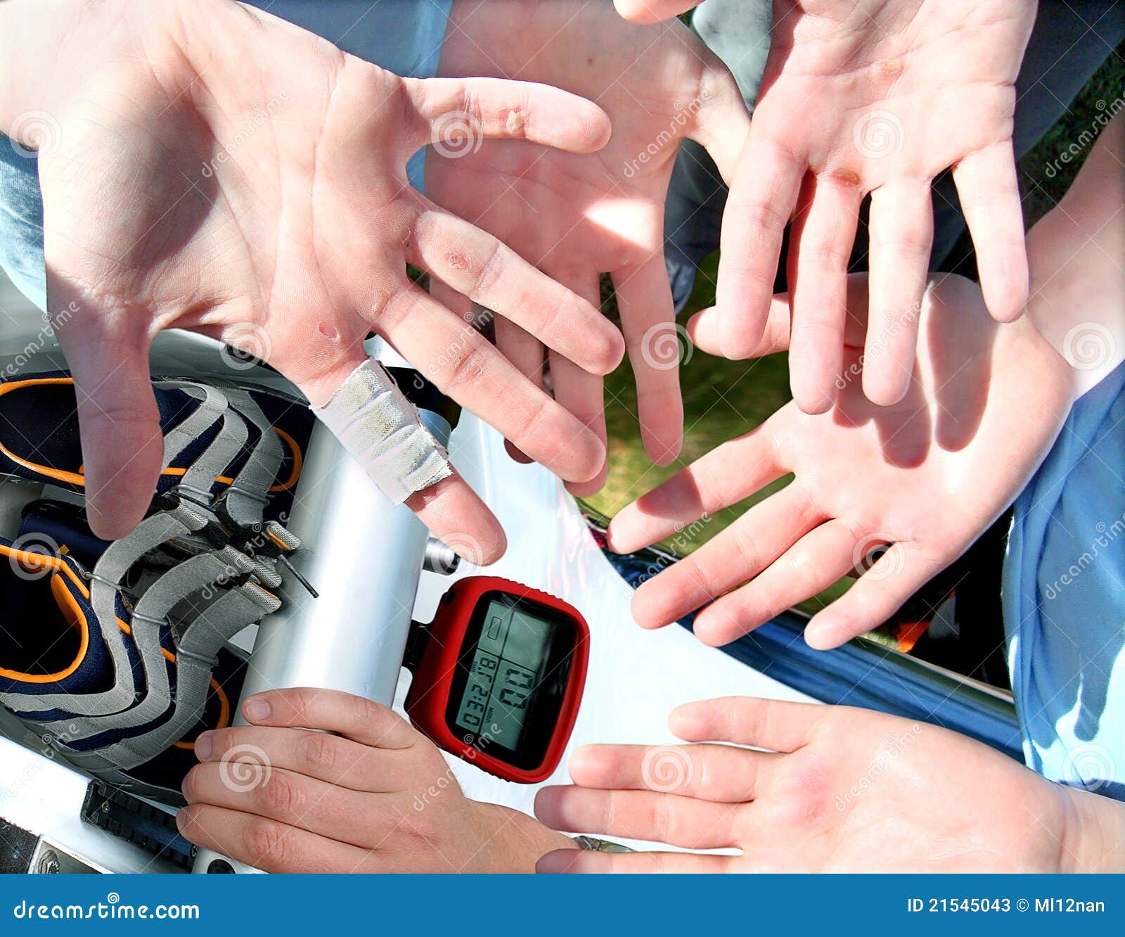 Callosities on hands stock image. Image of competitor - 21545043