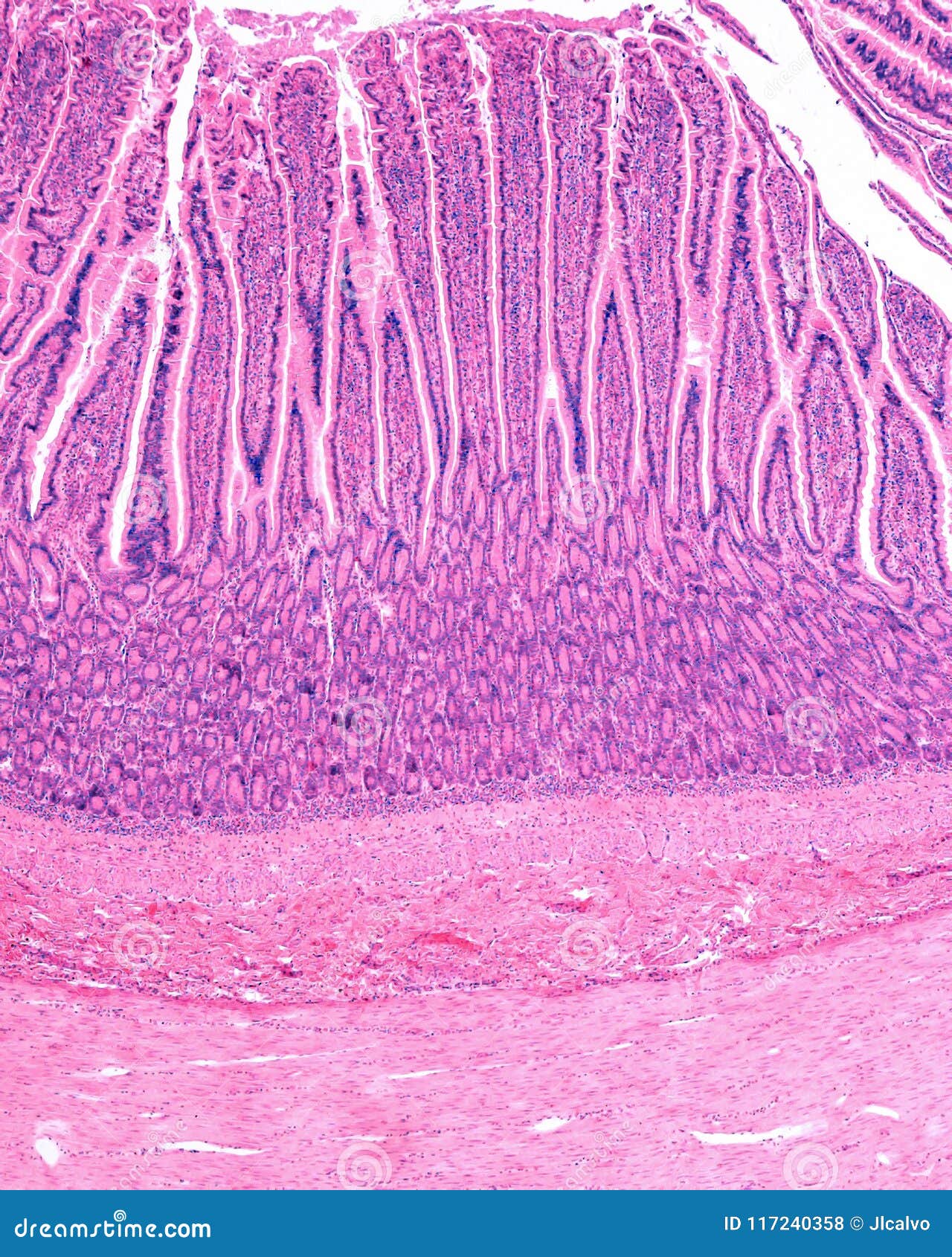 Histologia Do Intestino Delgado - SOLOLEARN - verloop.io