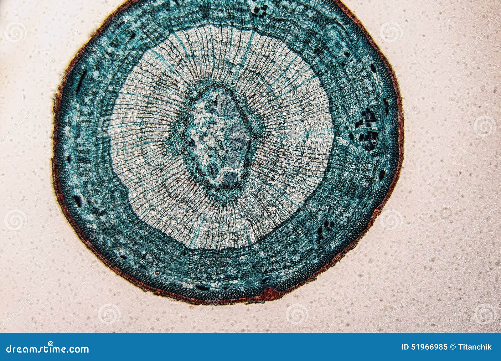 Tracheids Under Microscope