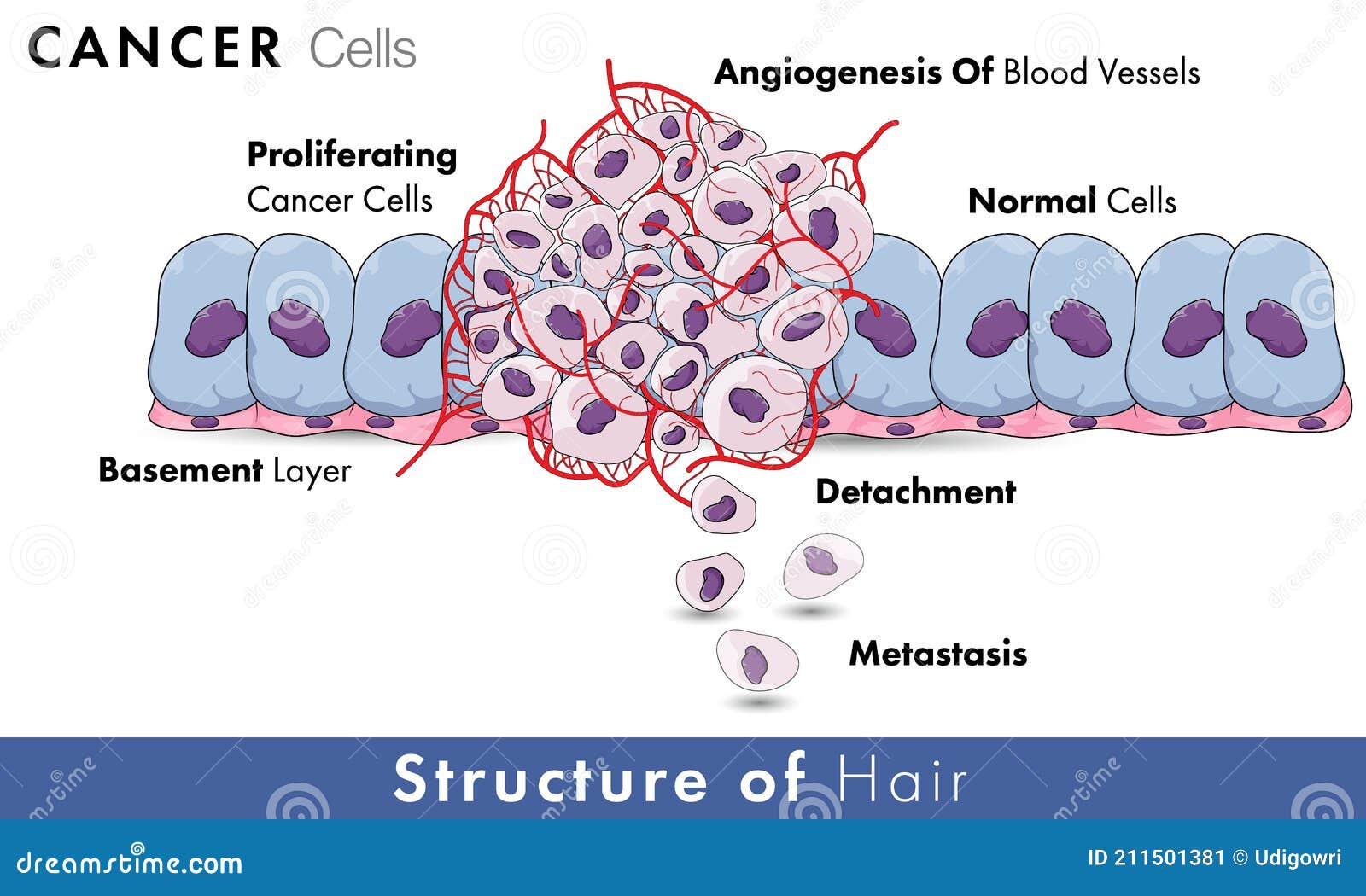 6 Differences Between Cancer Cells And Normal Cells Y - vrogue.co 6 Differences Between Cancer Cells And Normal Cells Y - vrogue.co