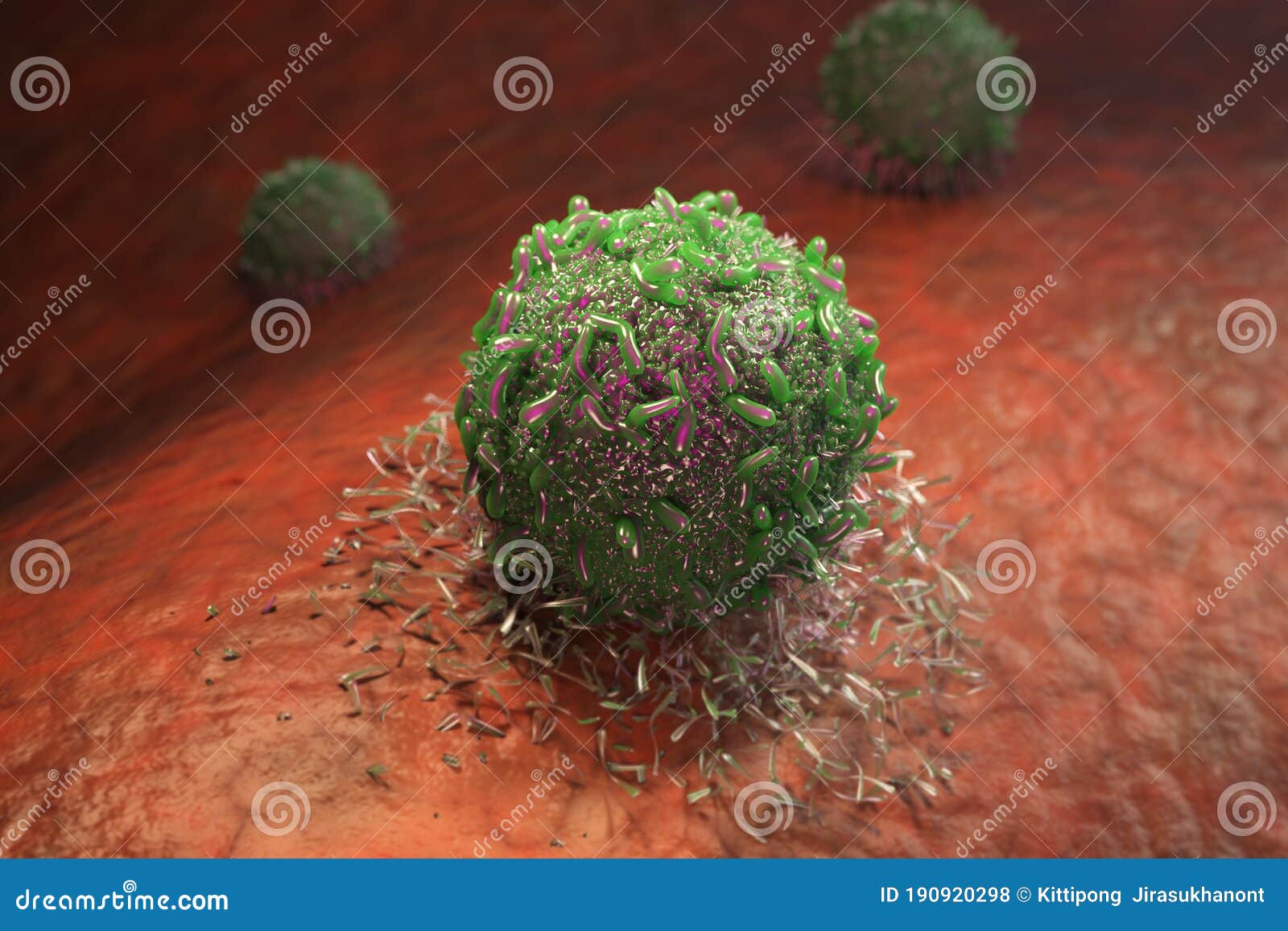 Metastasis: The Spread Of Cancer Cells From The Original Tumor To Other ...