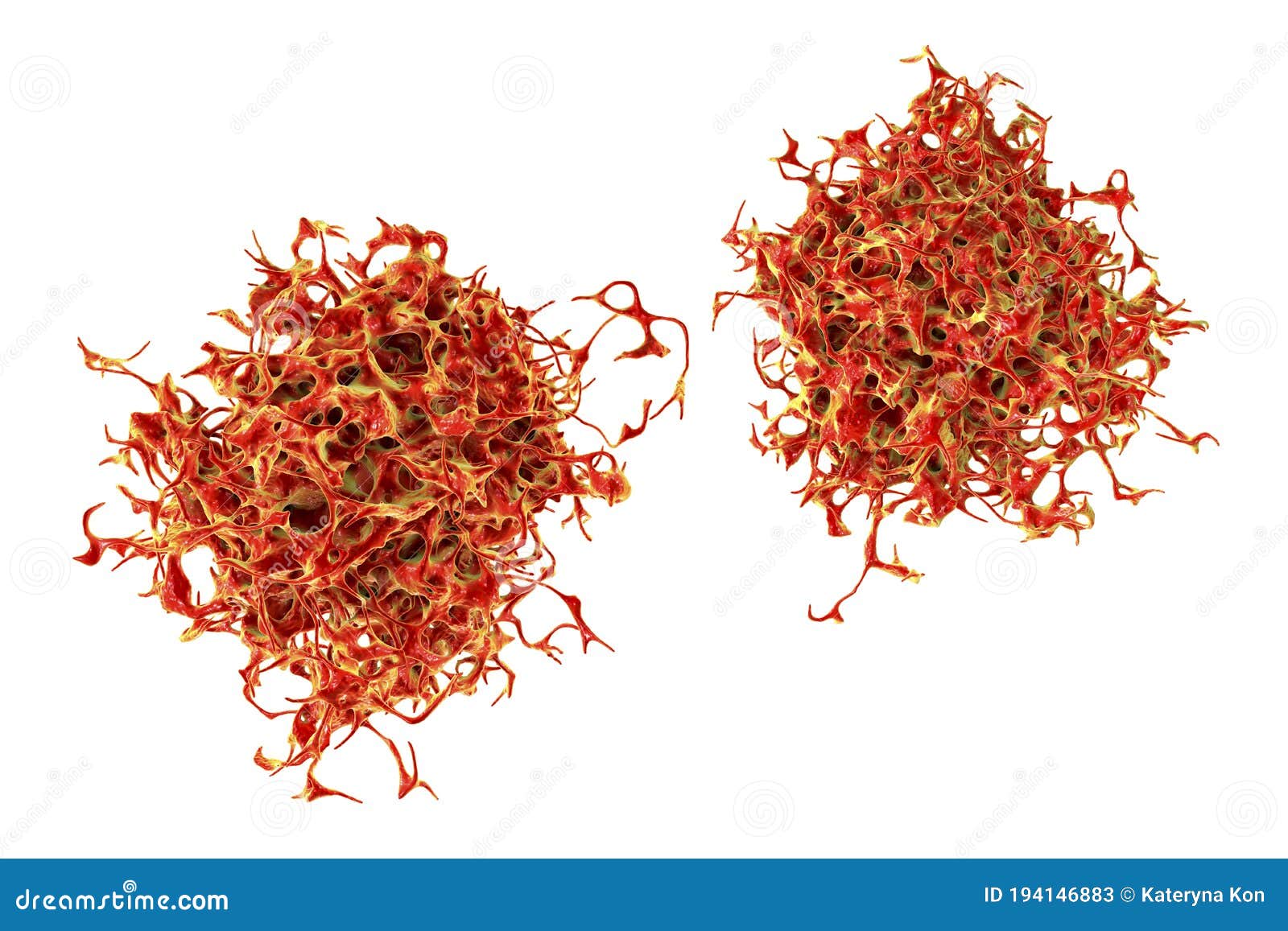 Cancer Cell, Malignant Tumor Cell Stock Illustration - Illustration of ...
