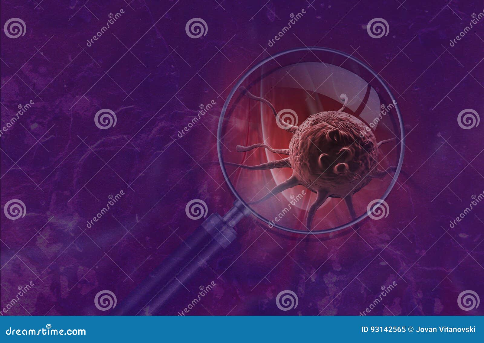 Cancer cells in human body stock illustration. Illustration of bacteria ...
