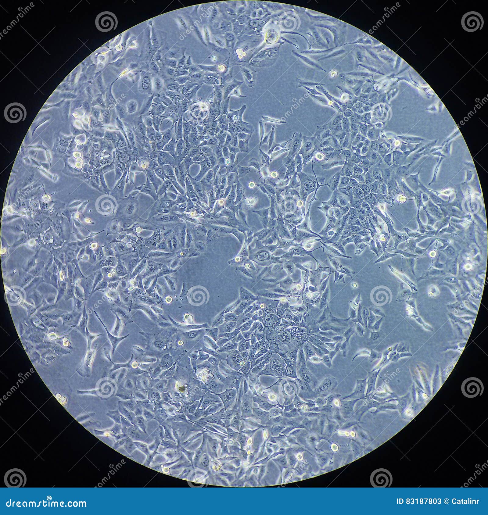 Cancer Cells Under Microscope Stock Image - Image of cell, human: 83187803