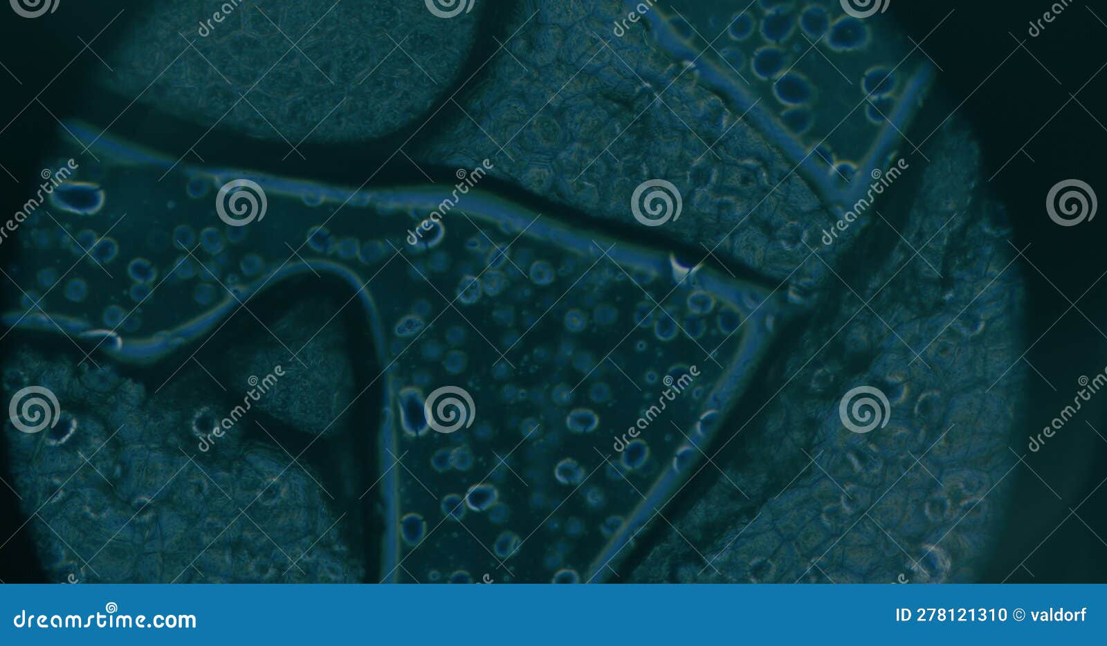 Cancer Cells Under Microscope at Laboratory Stock Footage - Video of ...