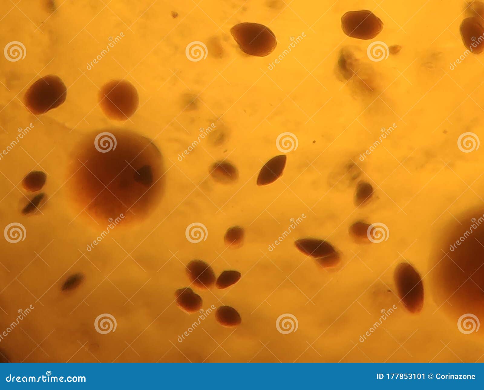 Candida Albicans and Bacterial Colonies Under the Microscope Stock ...