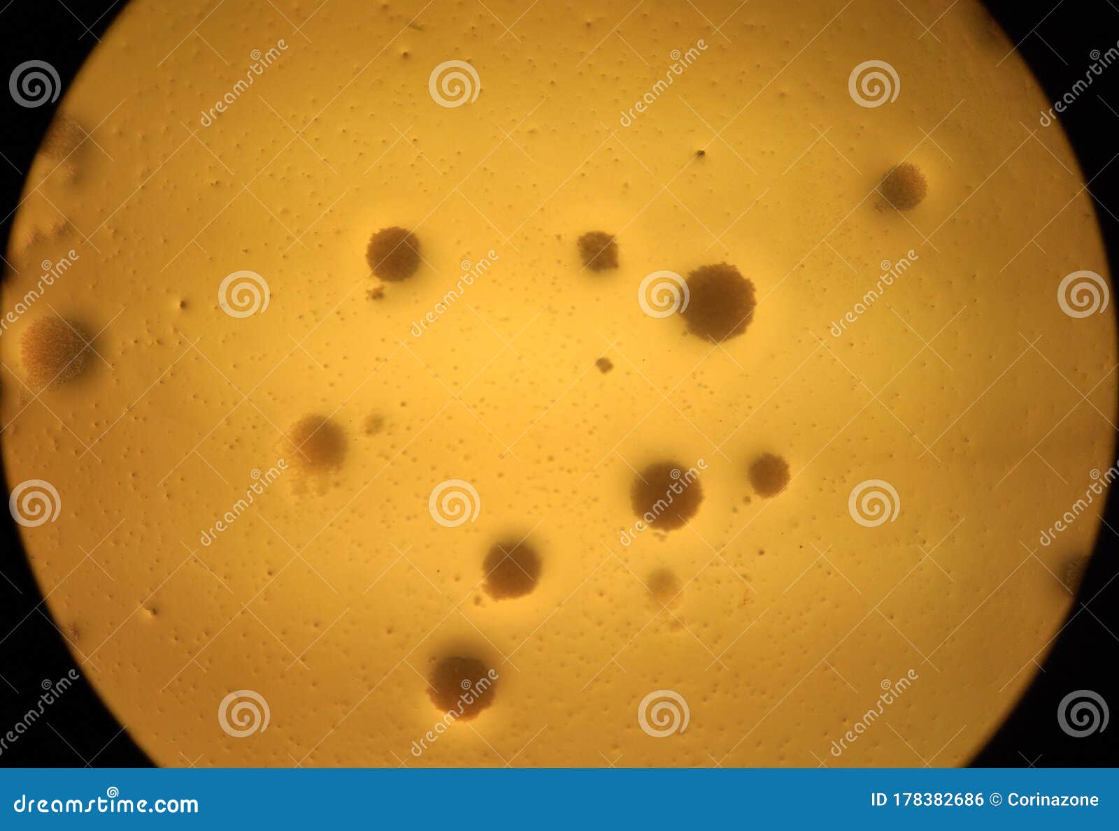 Microscope View of Candida Albicans Colonies Stock Photo - Image of ...