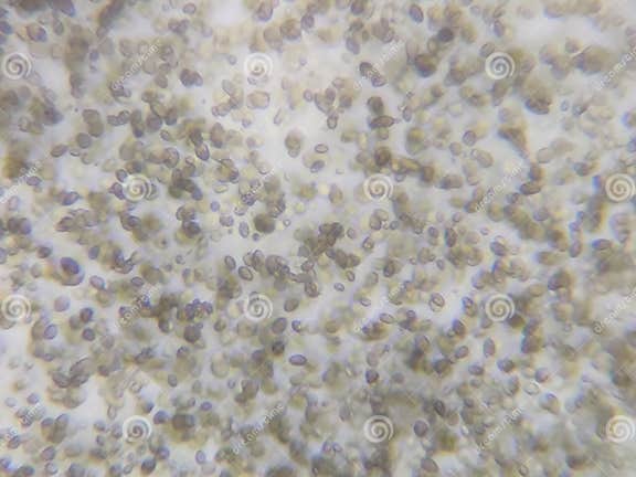 Candida Albicans Under the Microscope Stock Foto - Image of zodat ...