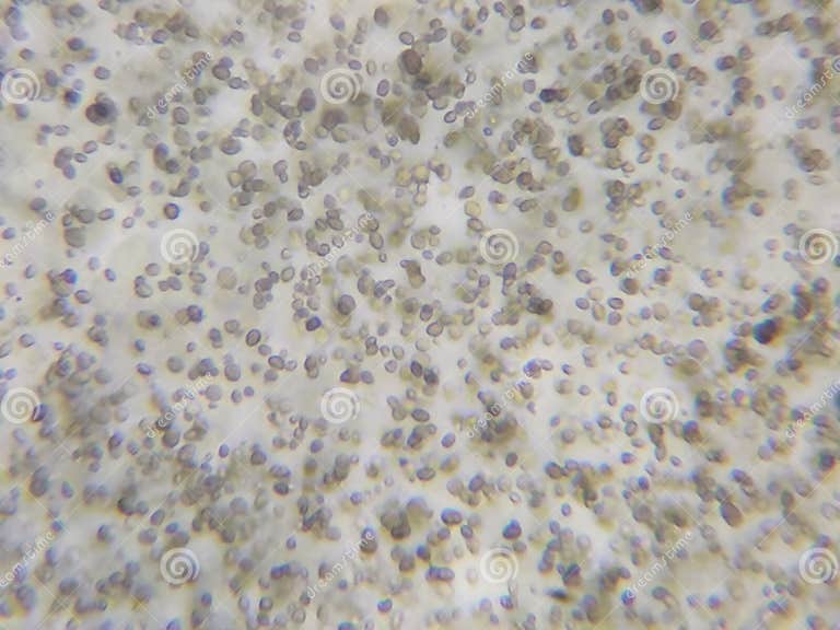 Candida Albicans Under the Microscope Stock Afbeelding - Image of groei ...