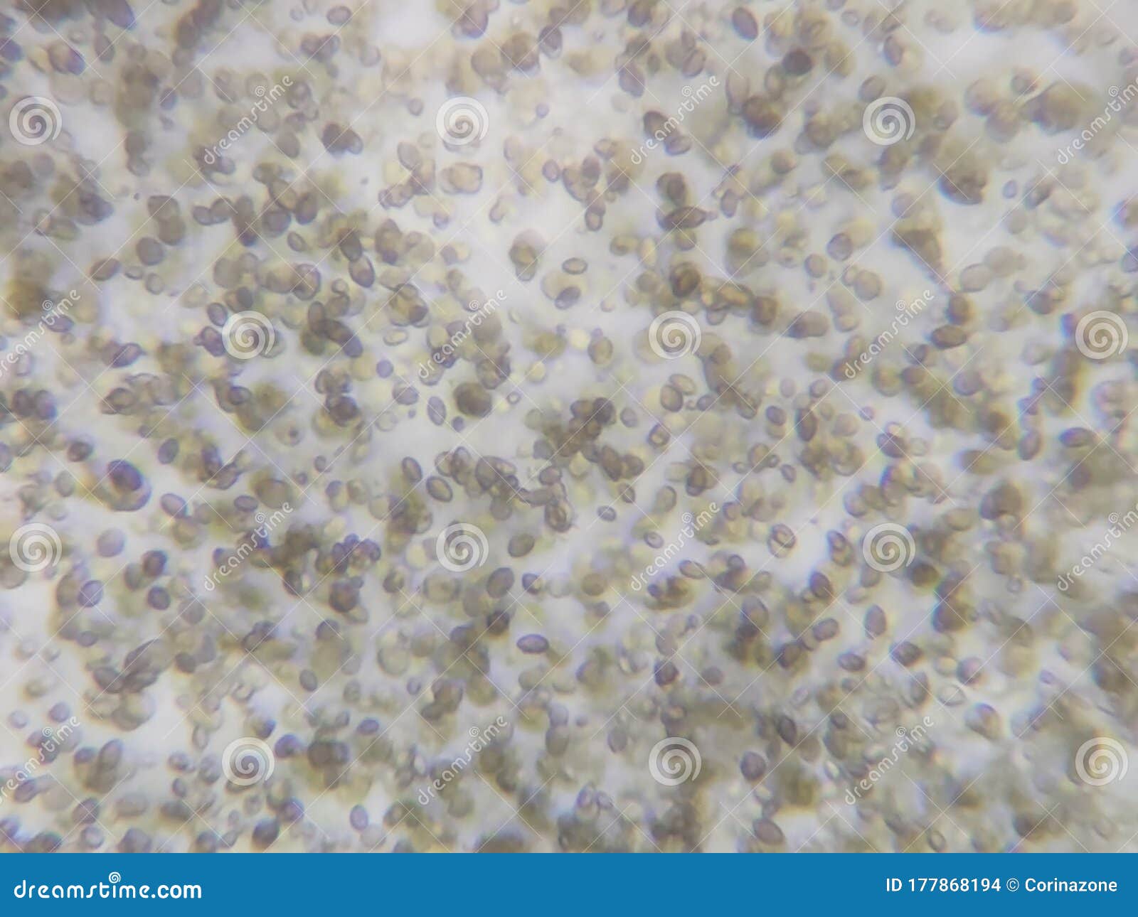 Candida Albicans Under the Microscope Stock Photo - Image of agar ...