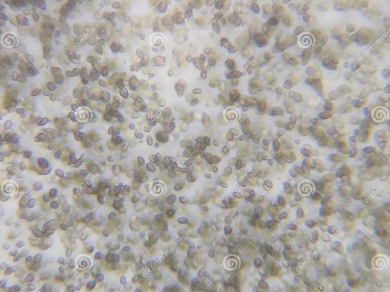 Candida Albicans Under the Microscope Stock Photo - Image of agar ...