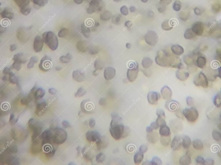 Candida Albicans Under the Microscope Stock Image - Image of ...