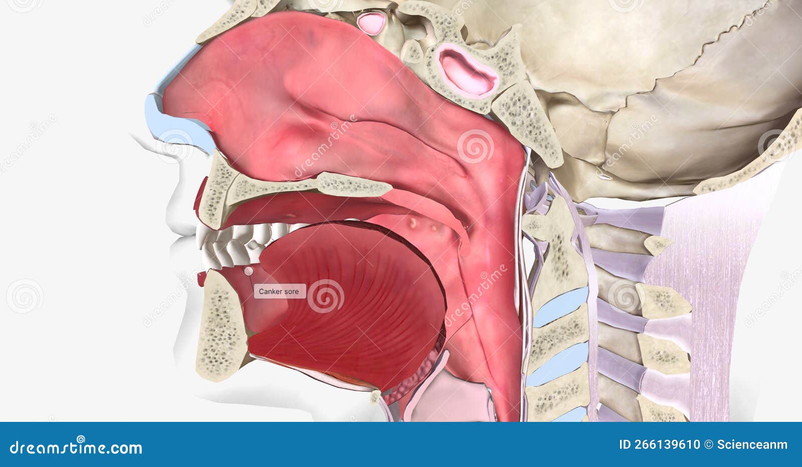 Canker Sores Also Called Aphthous Ulcers Are Small Round Sores On The Inside Of The Mouth Or