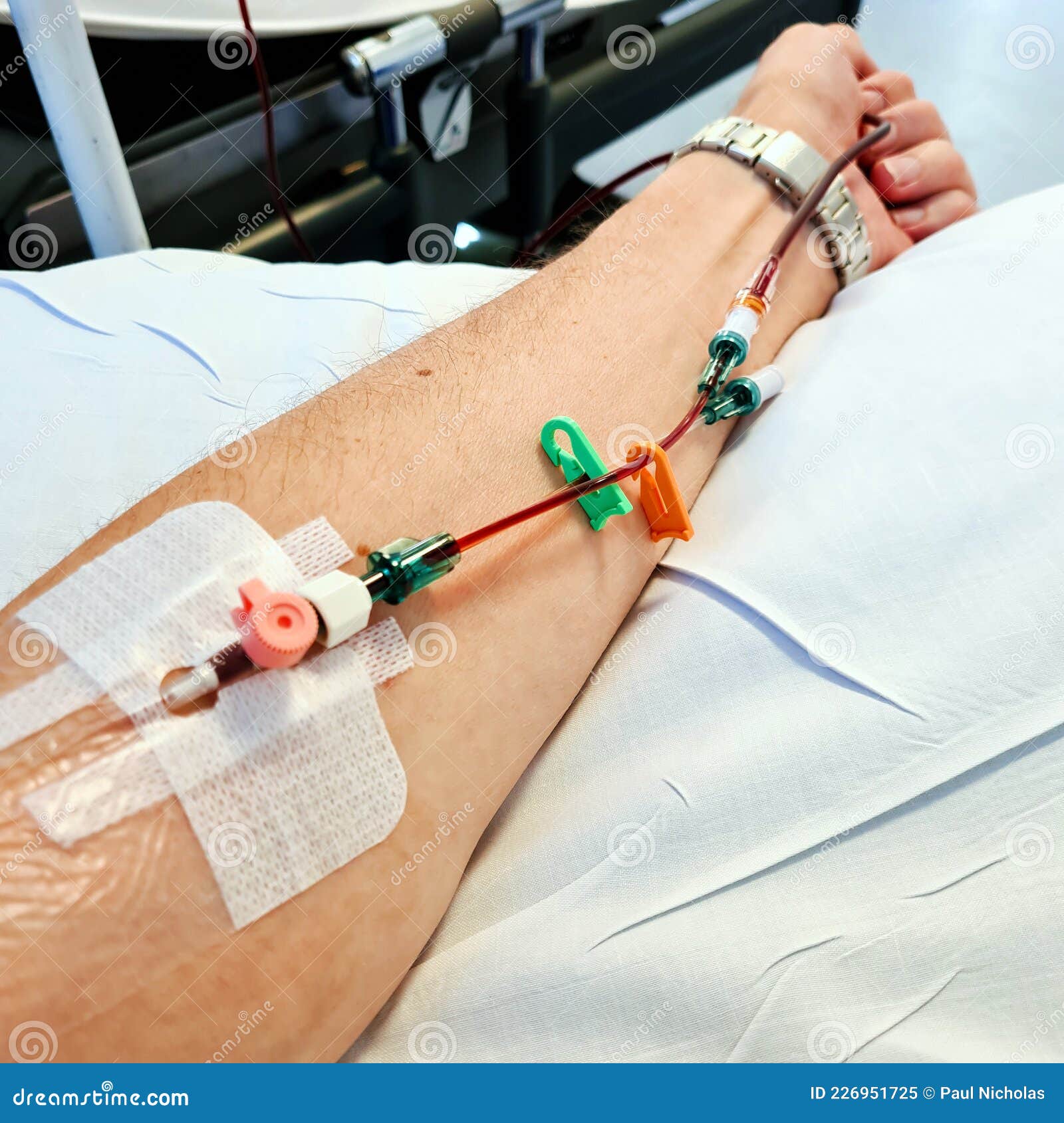 Cannula Ready for Iron Infusion Stock Image - Image of hospital ...