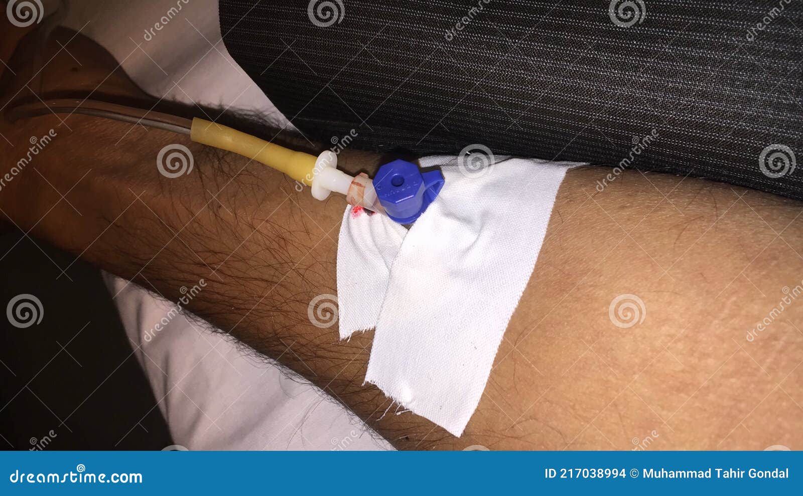 Canola stock photo. Image of fitted, canola, tape, surgical - 217038994