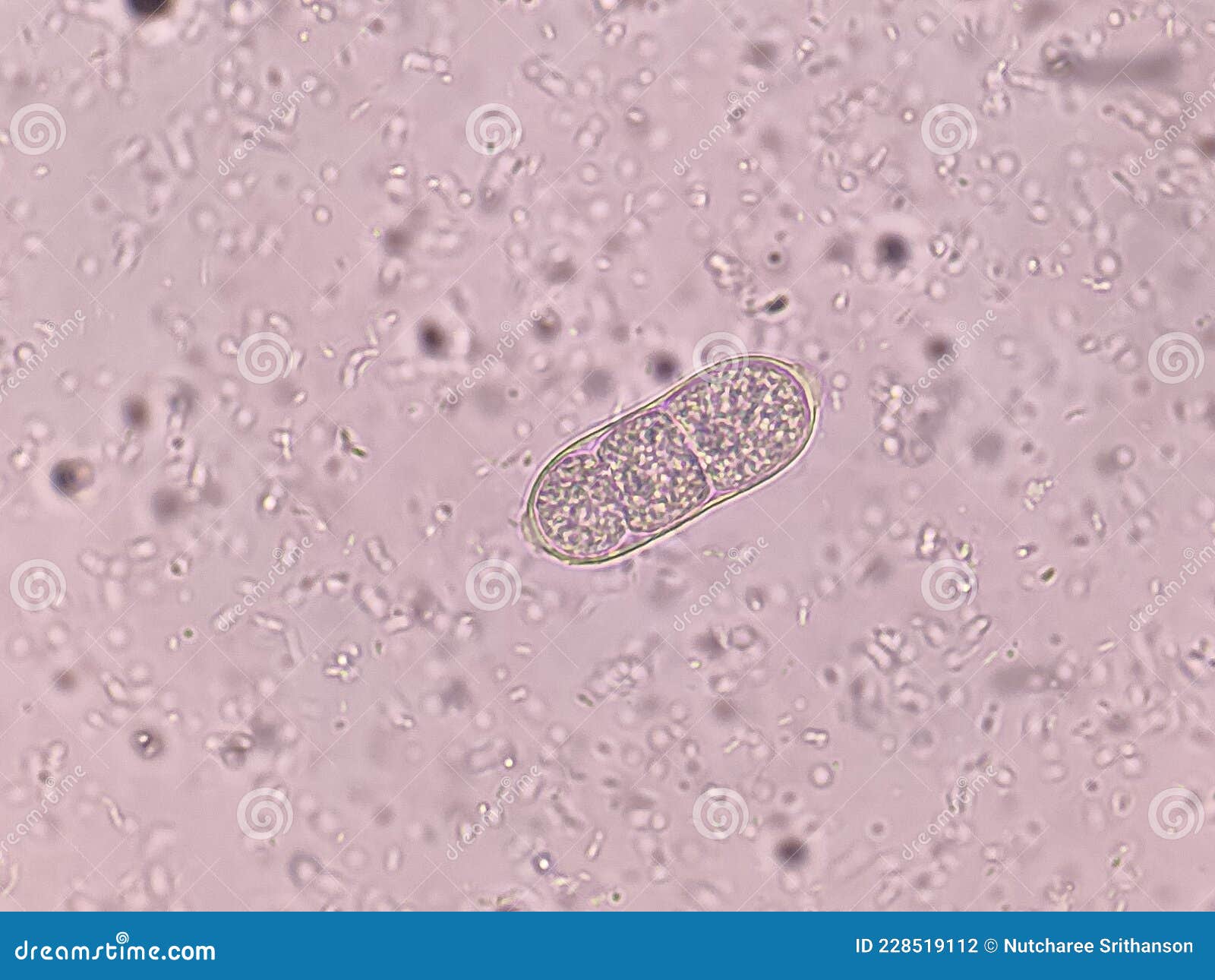 Capillaria Hepatica Egg