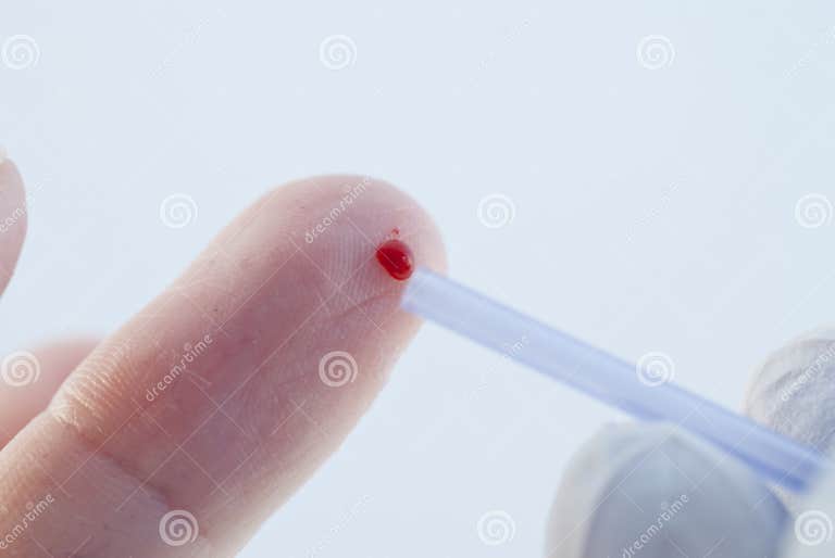 Capillary test stock photo. Image of sample, hand, pain - 19023012