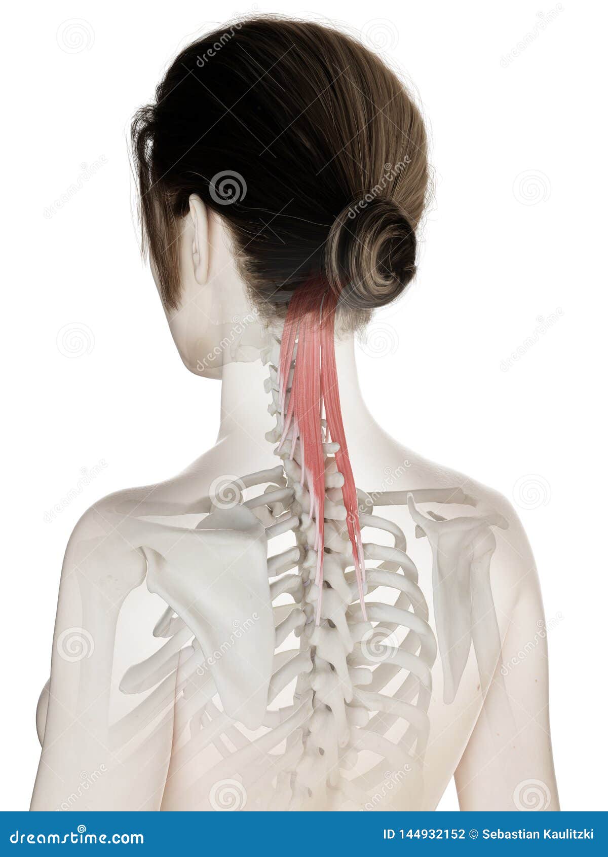 Capitis De Los Semispinalis De Una Mujer Stock de ilustración ...