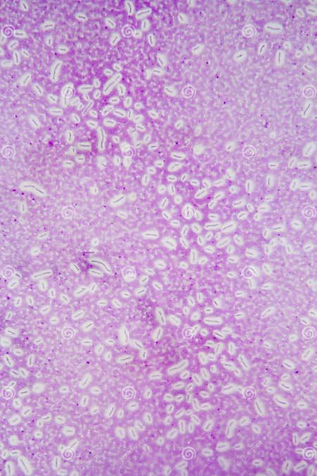 Capsule Stain of Bacillus Bacteria Stock Image - Image of research ...