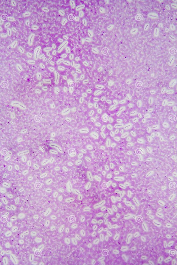 Capsule Stain of Bacillus Bacteria Stock Image - Image of research ...