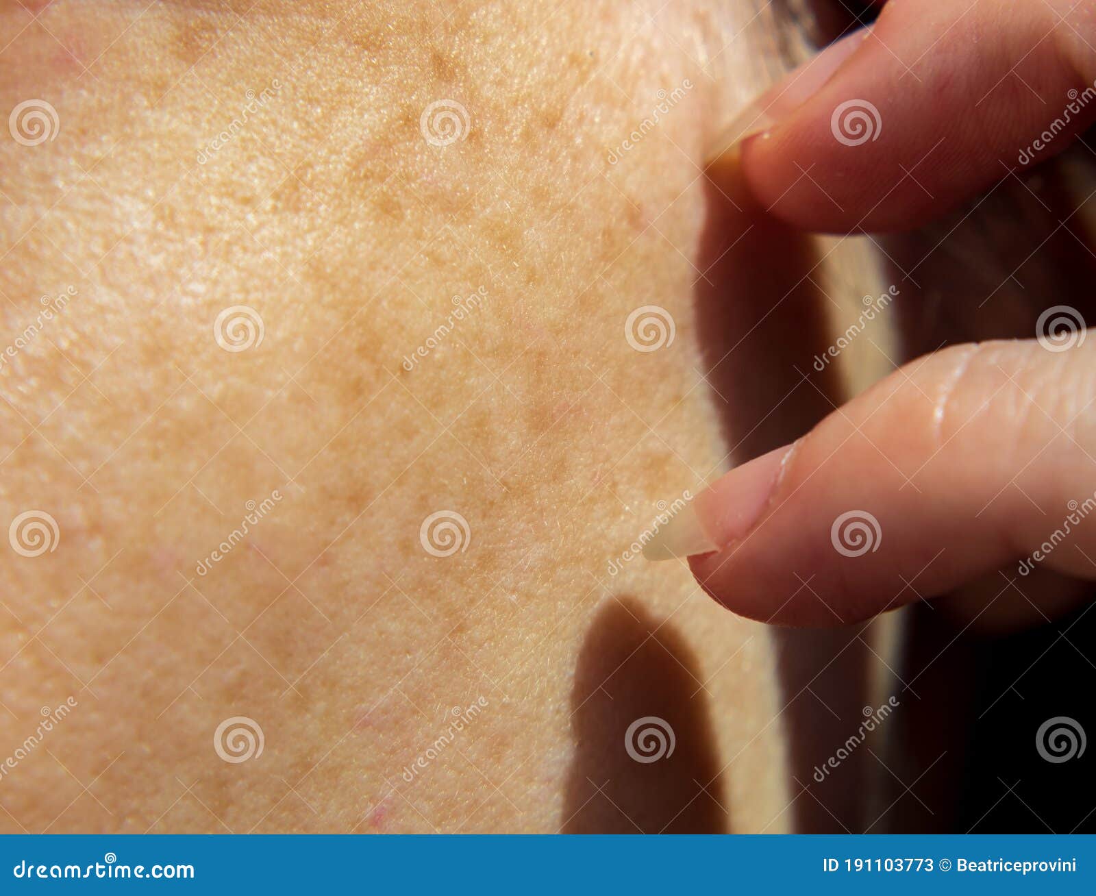 Cara De Piel De Mujer Con Pecas Imagen de archivo - Imagen de joven ...