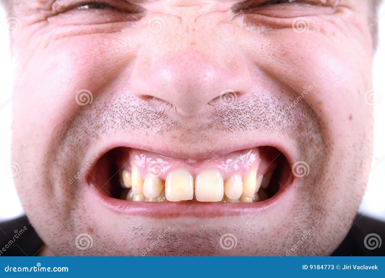 Cara Fea Del Hombre Asustadizo Imagen de archivo - Imagen de aterrador ...