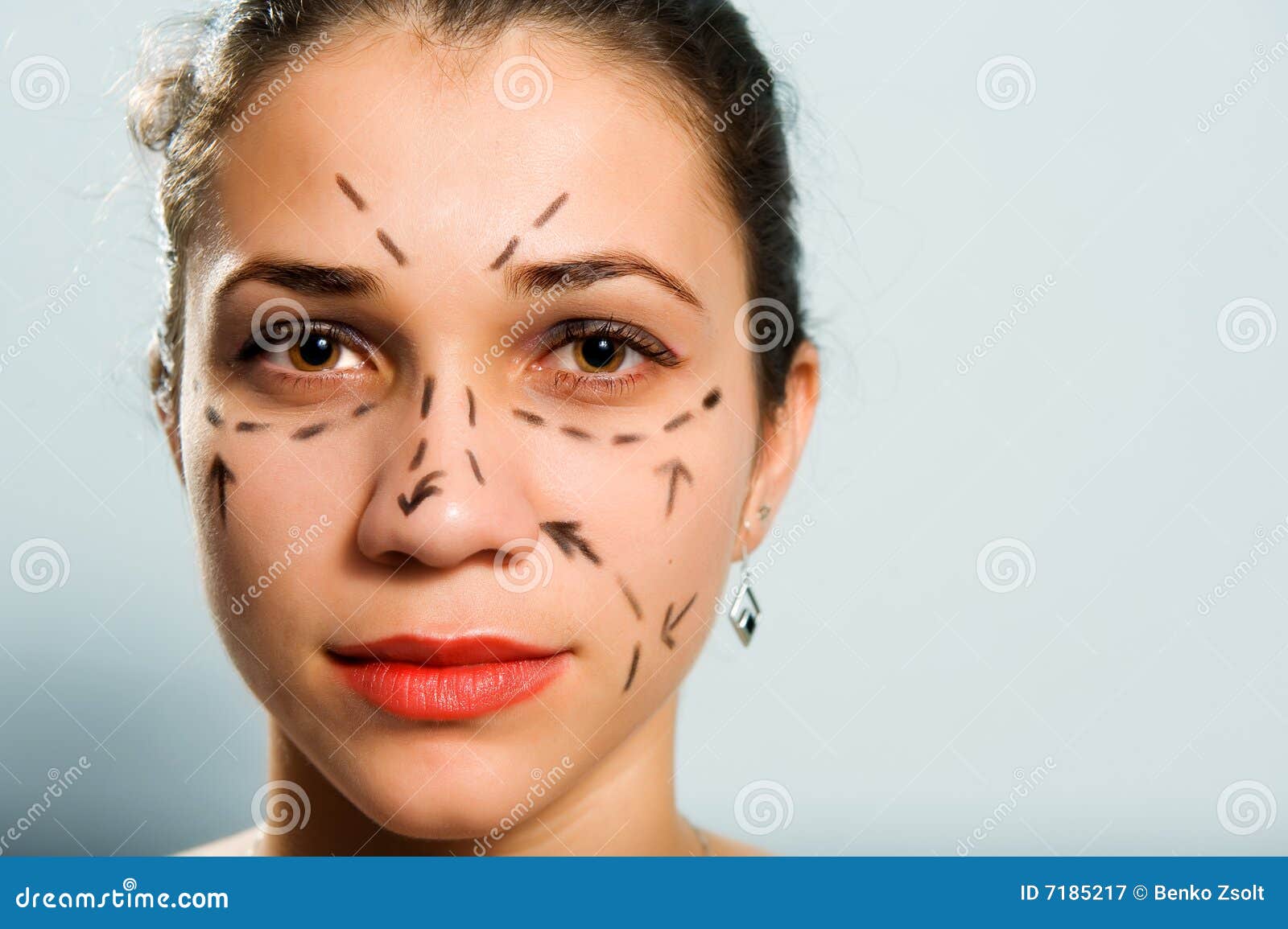 Cara Marcada Para La Cirugía Plástica Imagen de archivo - Imagen de ...