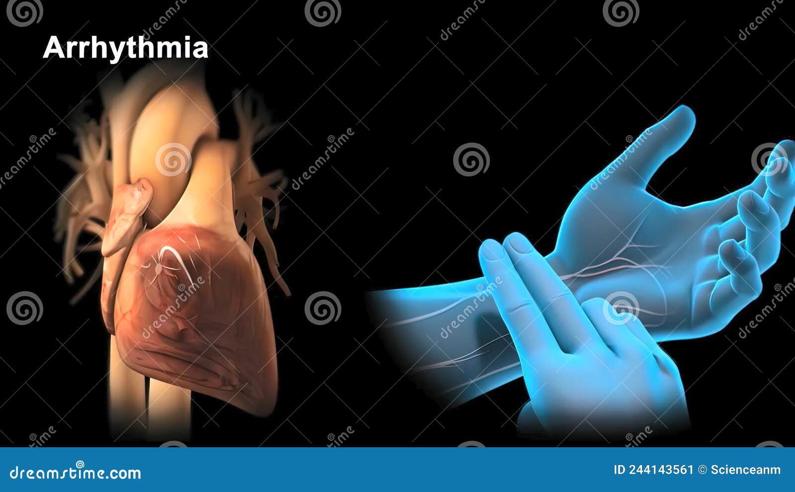 Conduction System Of The Heart. Cartoon Vector | CartoonDealer.com ... Conduction System Of The Heart. Cartoon Vector | CartoonDealer.com ...