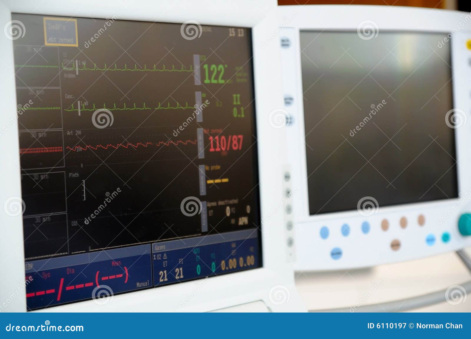 Cardiac Monitor stock image. Image of care, pulse, medical - 6110197