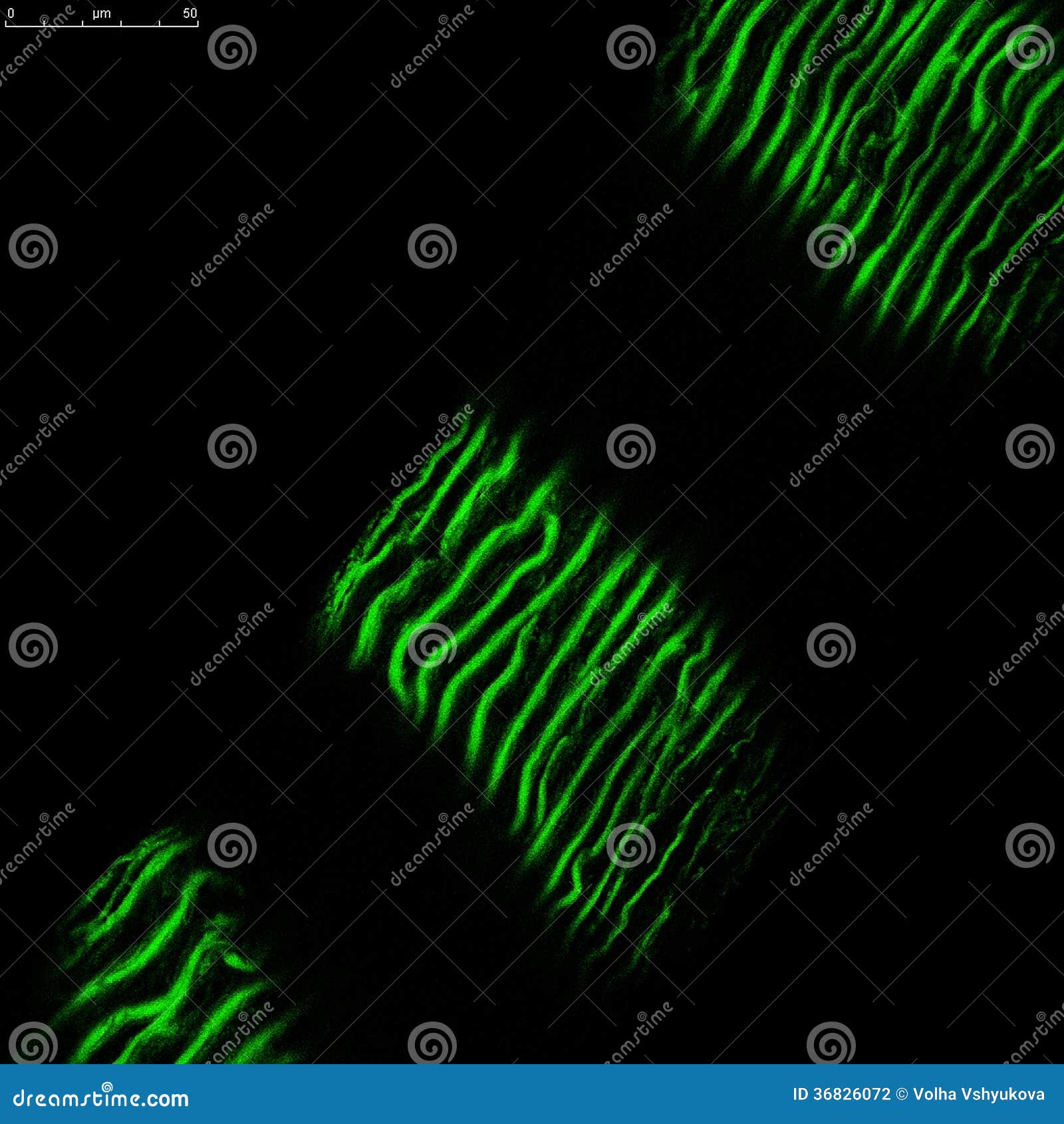 211 Green Muscle Disease Stock Photos - Free & Royalty-Free Stock ...