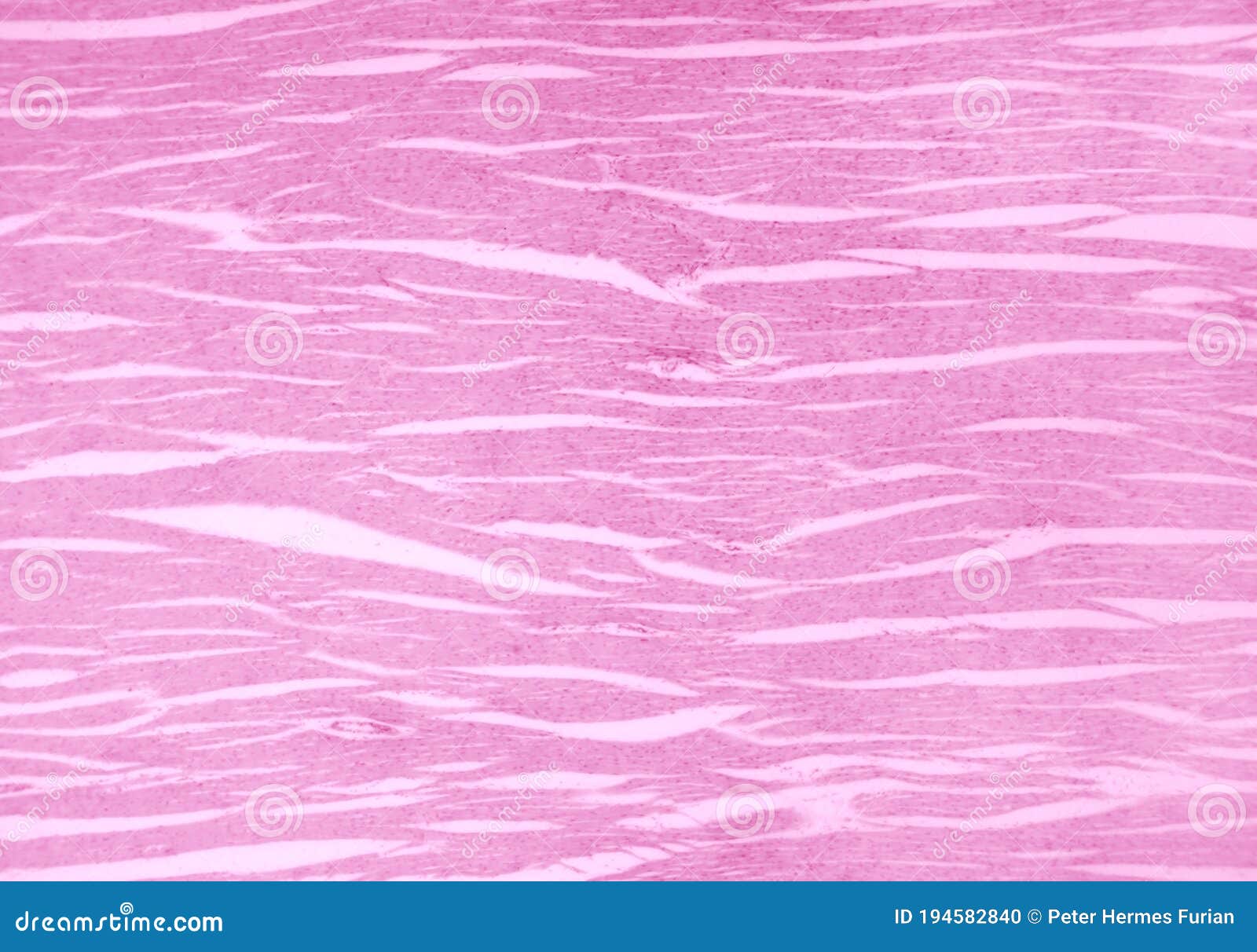 Cardiac Muscle Section, Heart Muscle, Myocardium Under Light Microscope ...
