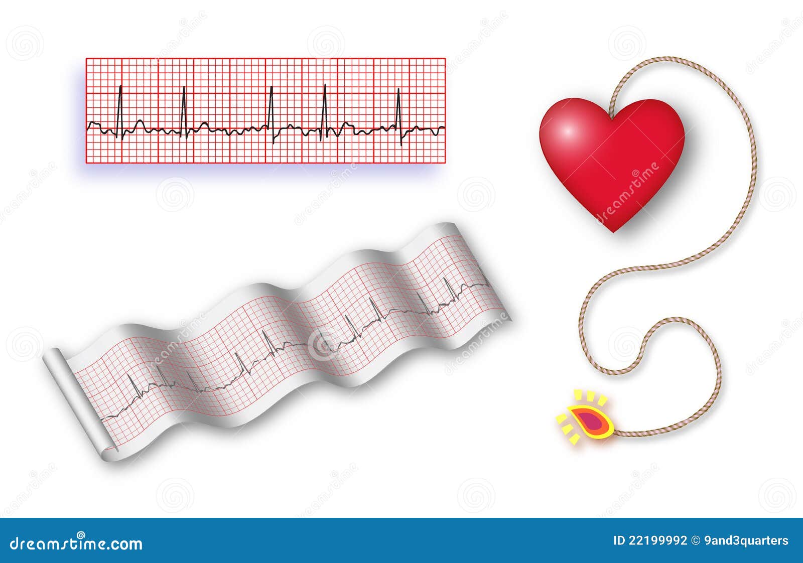 Ekg Strip