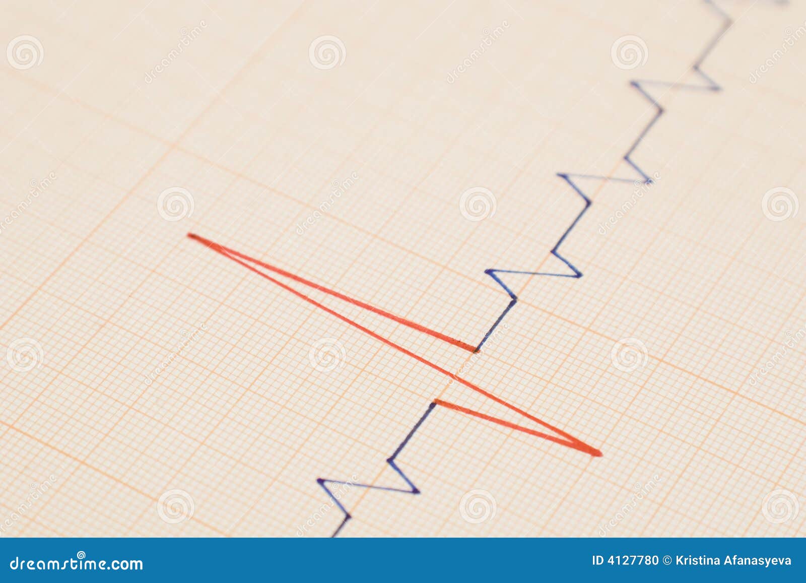 Cardio Graph stock photo. Image of illness, health, care - 4127780